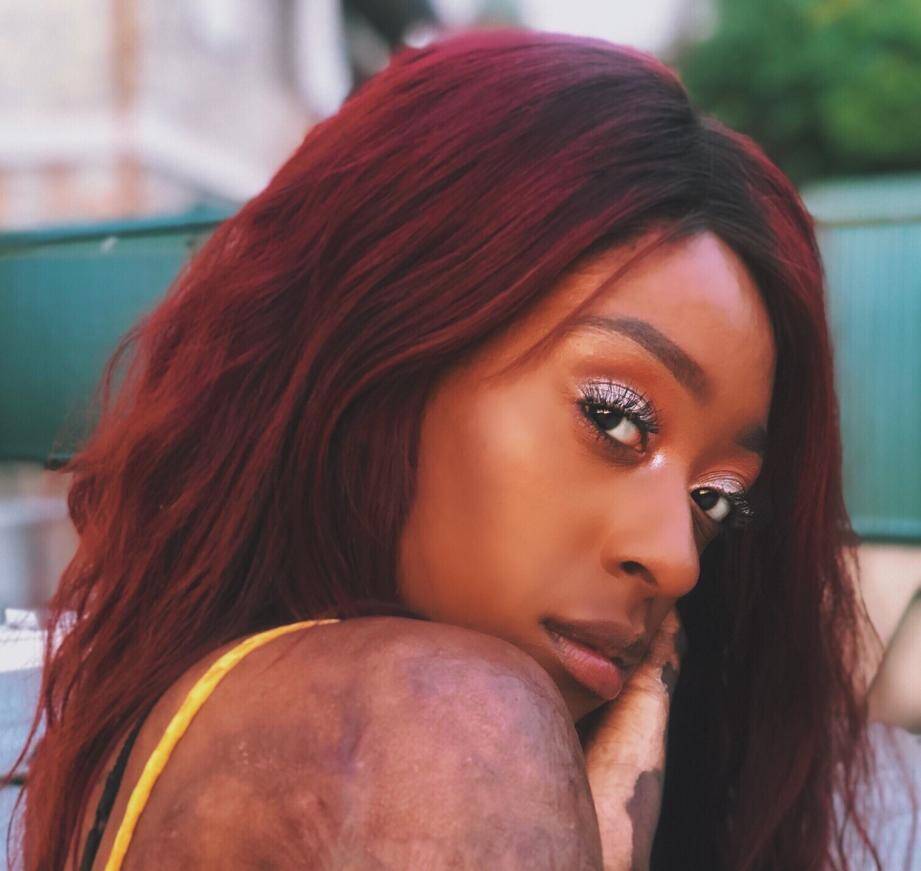 "Je ne suis pas qu’une survivante": handibasketteuse de haut niveau ...